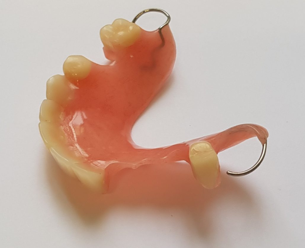 Partiële prothese (plaatprothese) - TTH Bilderdijk Tandprothese